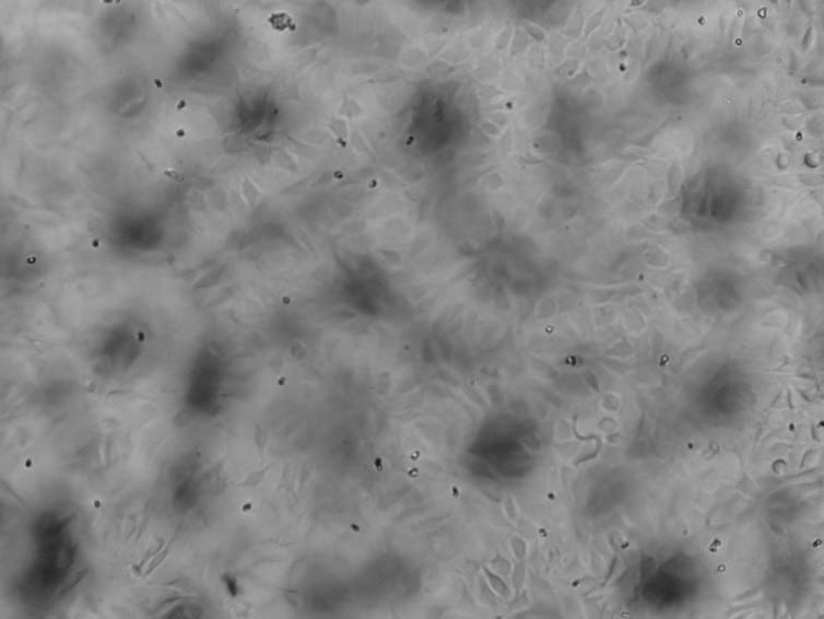 FAQs about live cell imaging and our incubator microscope - zenCELL owl